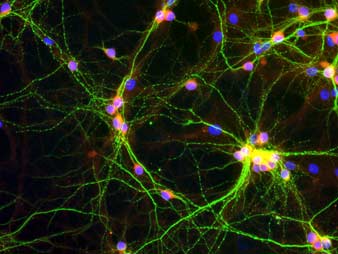 Redox Pathways Interconnect the Body | Dr. Gary Samuelson